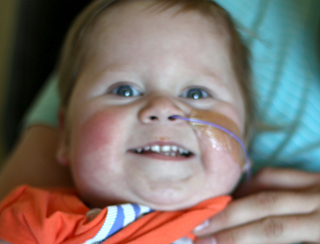 The miraculous survival of baby with ectopia cordis