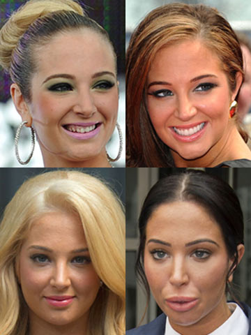 OH GOD! Tulisa Contostavlos admits to 'face-lift' treatments - CelebsNow