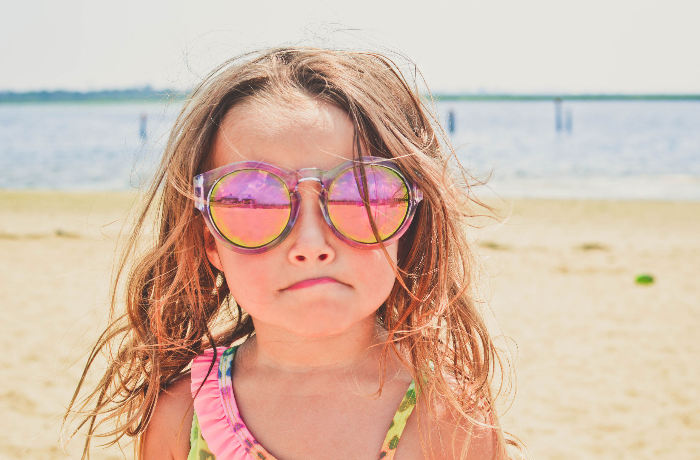 Heat rash treatment: How to treat prickly heat